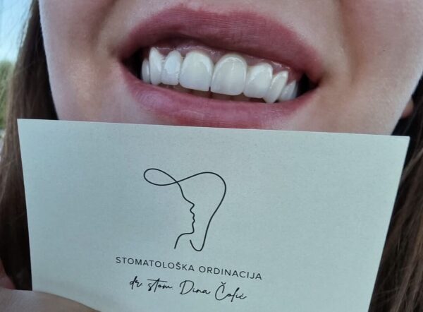 Estetska stomatologija - dr. Dina Čolić Herceg